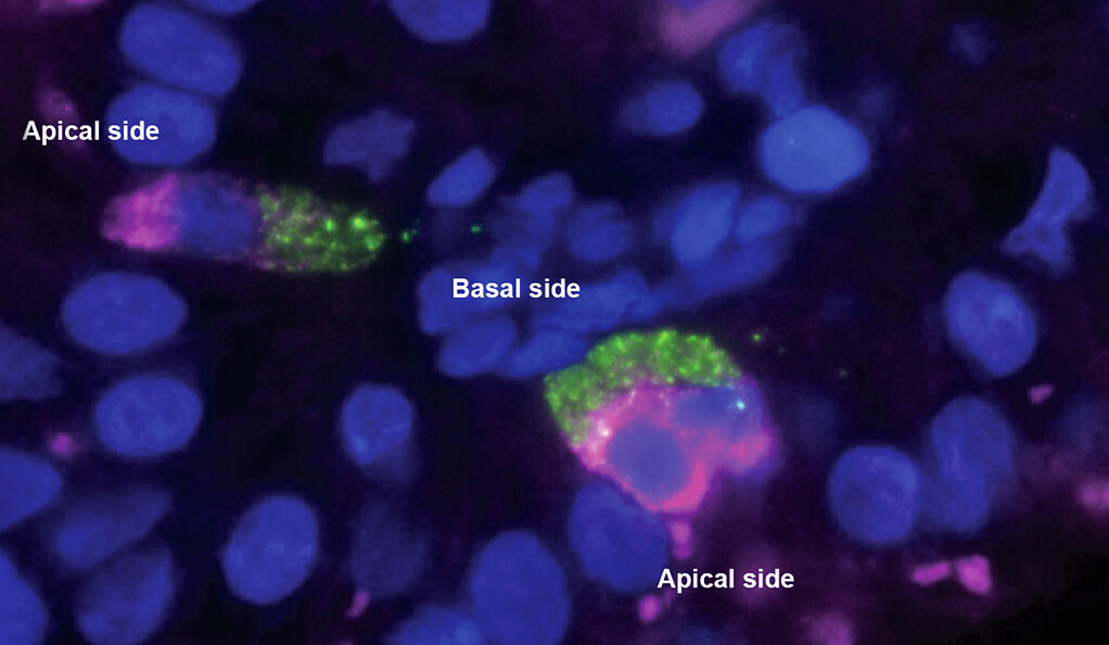 Insulin made outside the pancreas too, Yale study shows | Association ...